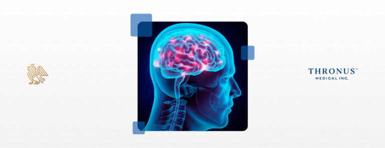 Cannabis medicinal é esperança contra convulsões causadas por epilepsia ...